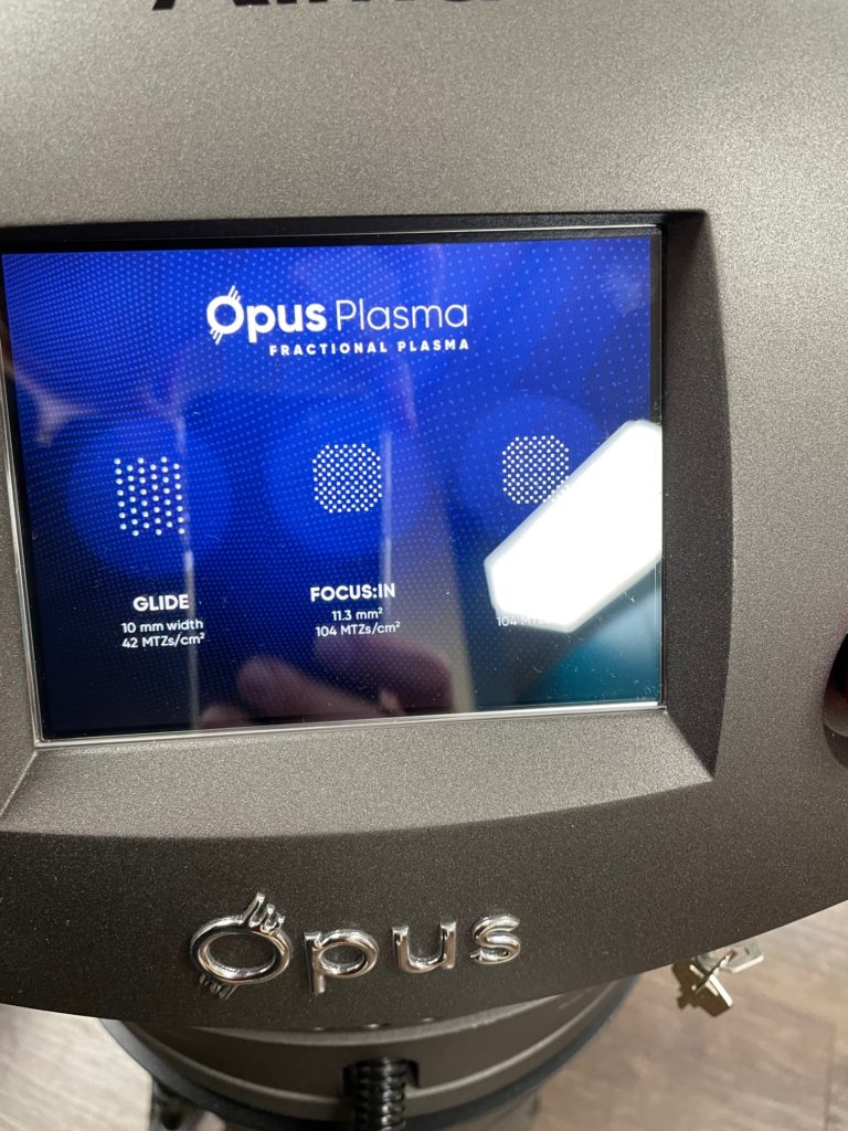 2020 Alma Opus Plasma RF Fractional Skin Resurfacing (jp/sor) - Rock ...