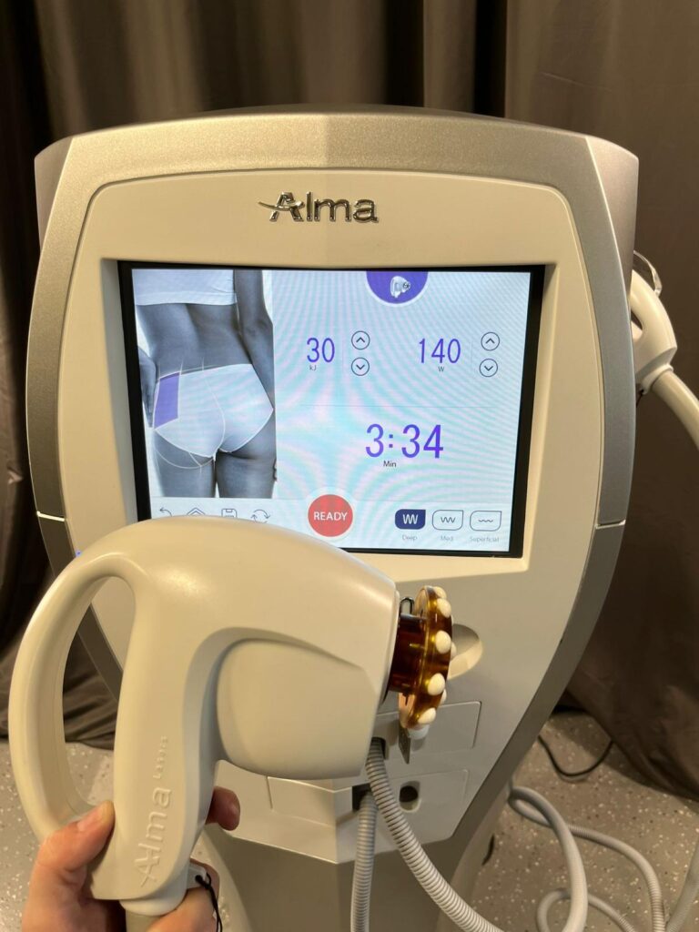 2018 Alma Accent Prime RF Body Contouring with Microplasma Pixel ...