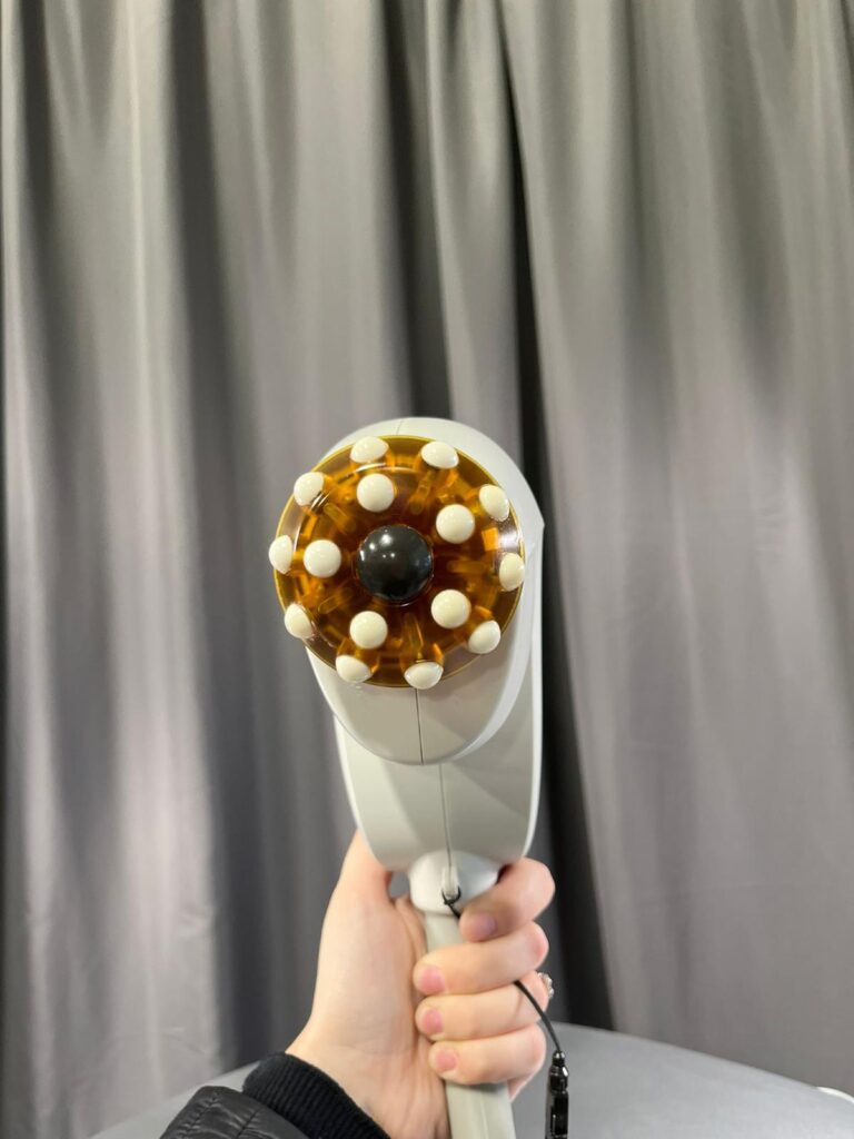 2018 Alma Accent Prime RF Body Contouring with Microplasma Pixel ...