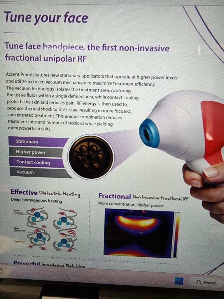 2018 Alma Accent Prime RF Body Contouring with Microplasma Pixel ...