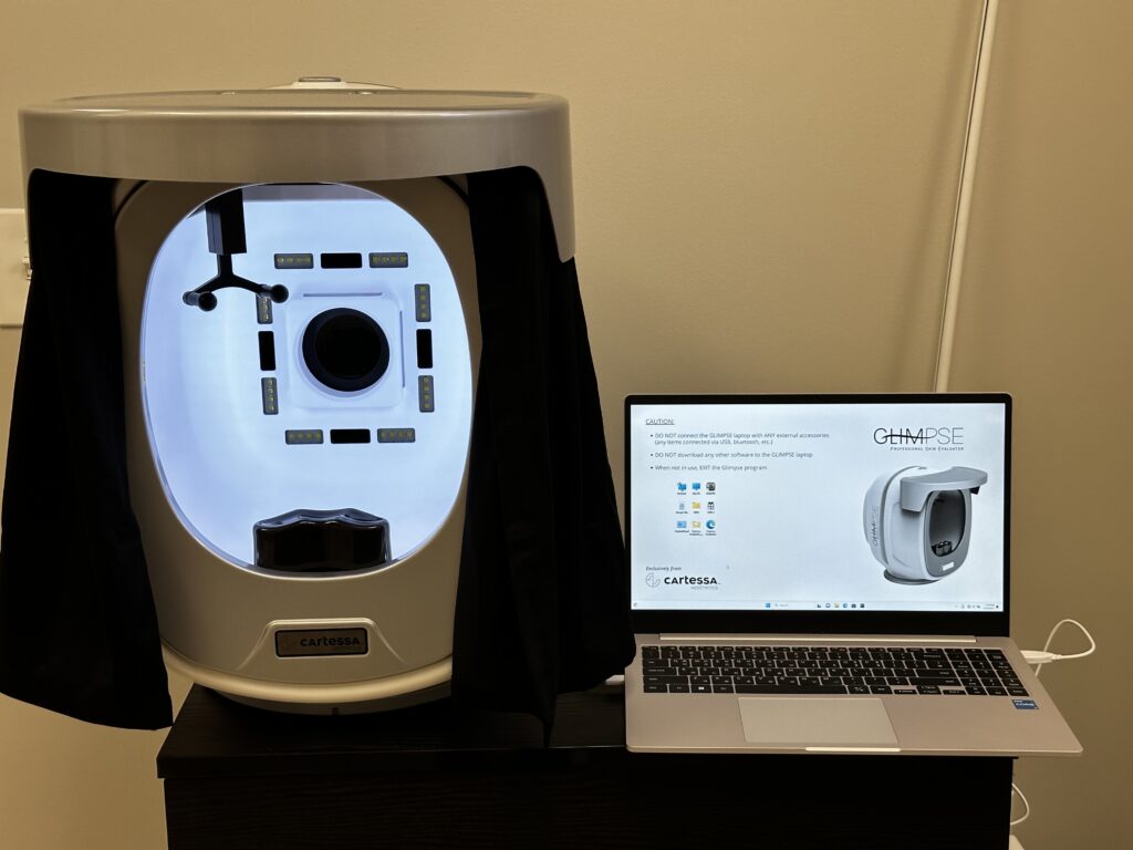 2024 Cartessa Glimpse Professional Skin Evaluator / Complexion Analysis ...
